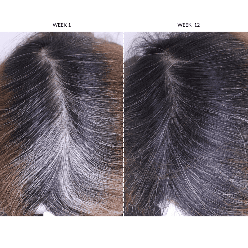 LED Hair Growth Helmet | Red Light Therapy for Hair Loss | CurrentBody CA